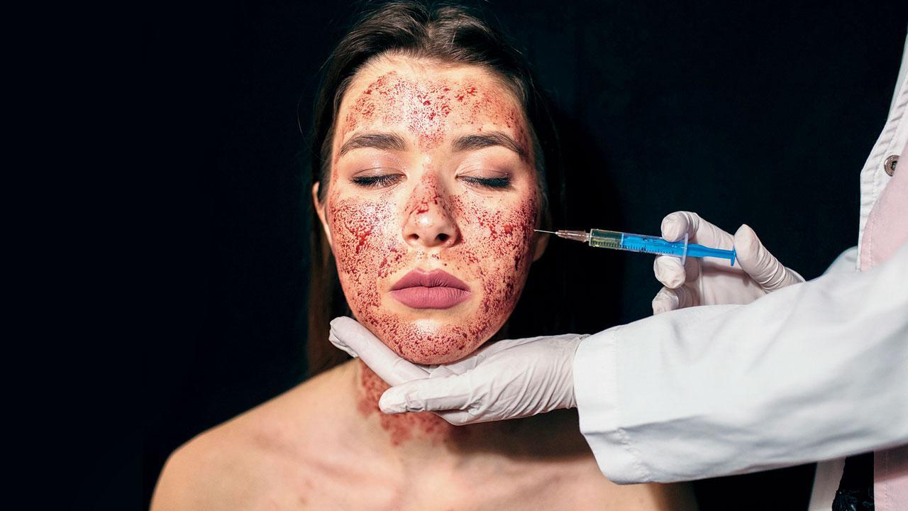 Exploring Skin Needling: Process, Benefits, and Potential Side Effects ...