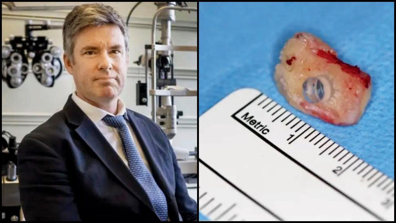 Canadian Surgeons Restore Blind Man’s Sight with Tooth in Medical ...